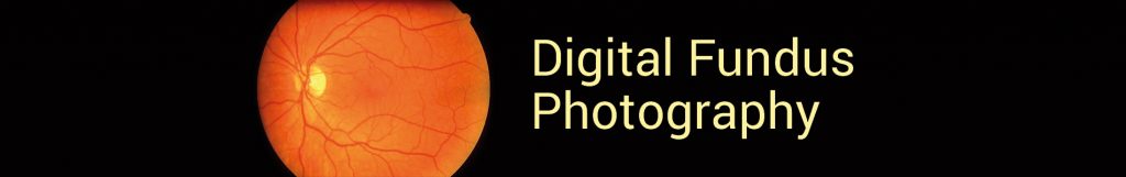 Fundus Photography in Billingham & Middlesbrough